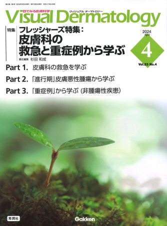 Visual Dermatology『Visual D． 2024年4月号 Vol．23 No．4』 ｜ 学研出版サイト