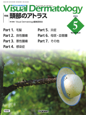 Visual Dermatology『Visual D． 2024年5月号 Vol．23 No．5』 ｜ 学研出版サイト