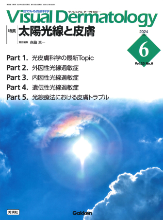 Visual Dermatology『Visual D． 2024年6月号 Vol．23 No．6』 ｜ 学研出版サイト